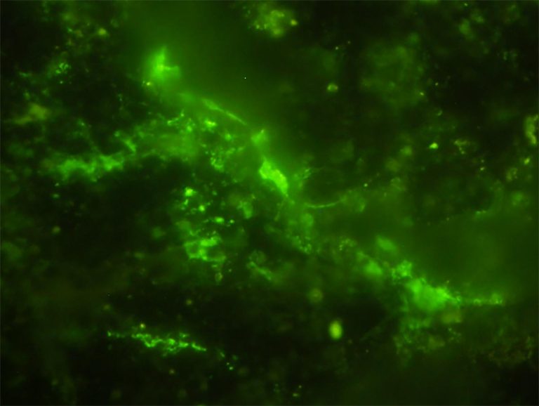 Earth’s Oldest Living Organisms Discovered Trapped in 2-Billion-Year ...
