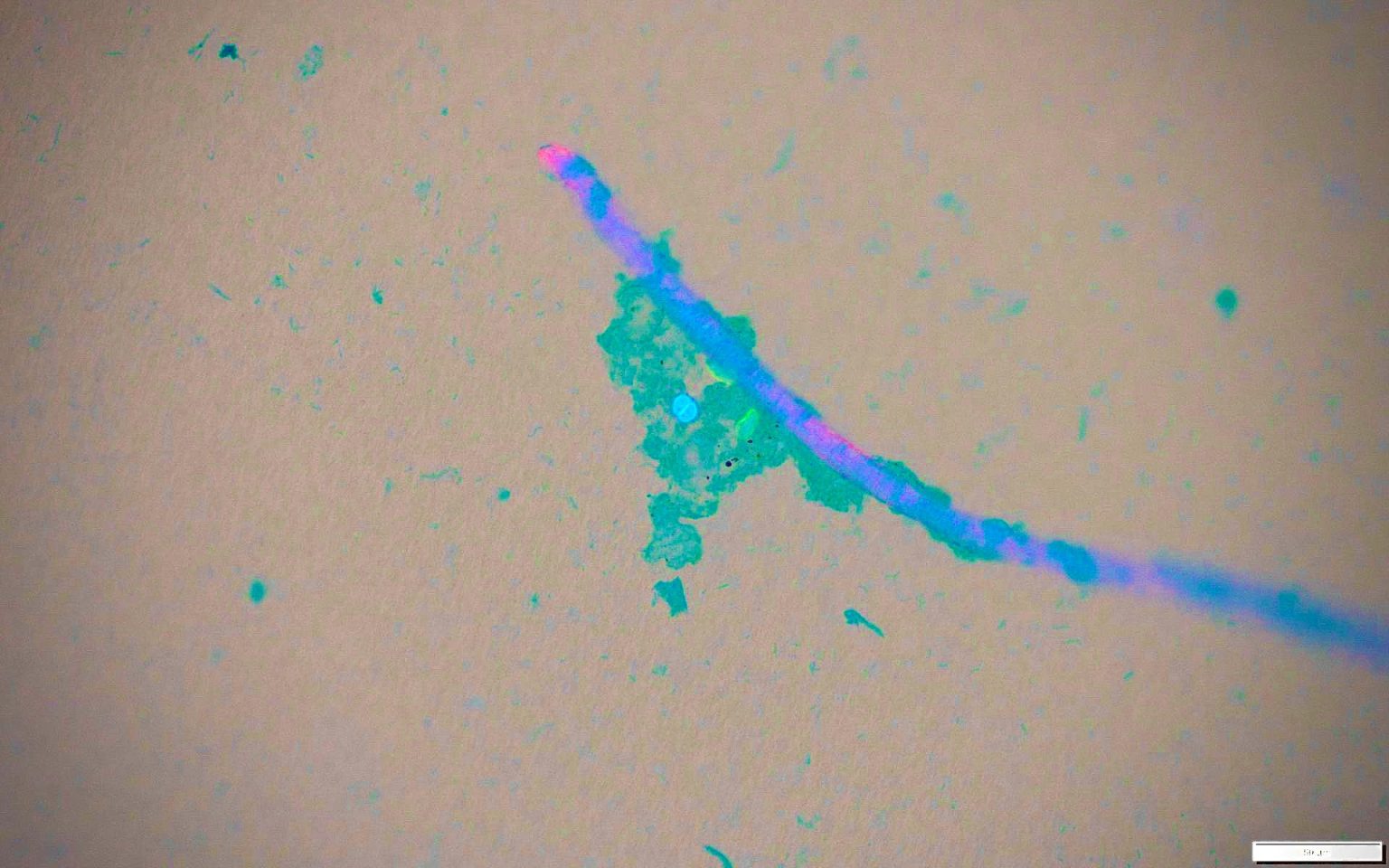 Microplastics Can Carry Parasites to Ocean, Affecting Wildlife and ...