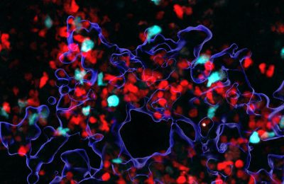 Researchers Discover a New Mechanism of Cancer Immune Defense