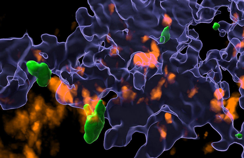 Researchers Discover a New Mechanism of Cancer Immune Defense