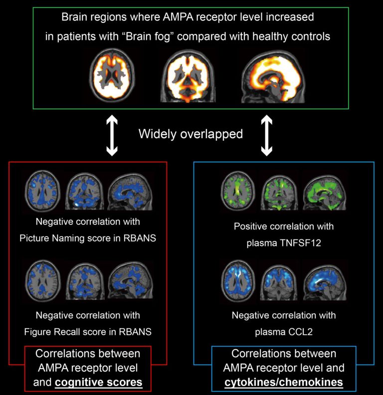 Scientists Finally Reveal Biological Basis of Long COVID Brain Fog