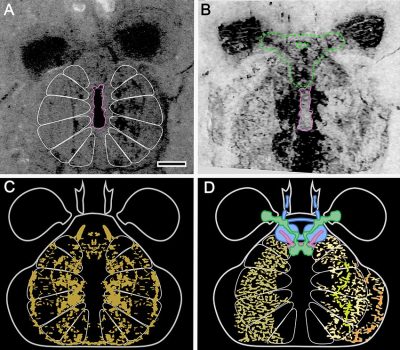 This 500-Million-Year-Old Sea Creature Had a Brain Like a Spider