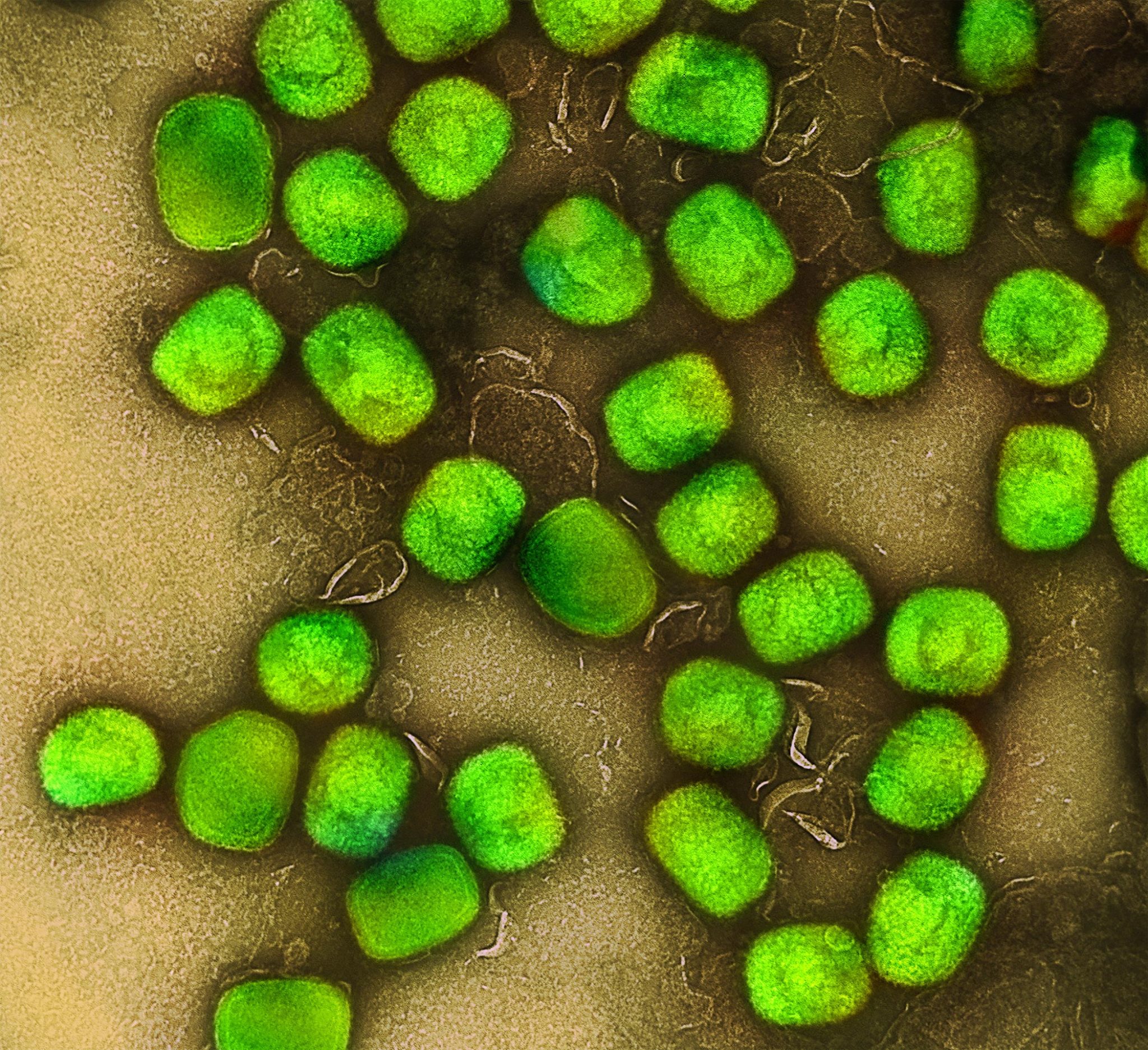 Monkeypox FAQ: Where Did It Come From? How Is It Transmitted? What Are ...