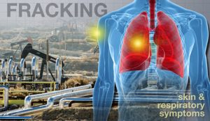 Yale Study Shows More Health Symptoms Reported Near ‘Fracking’ Sites