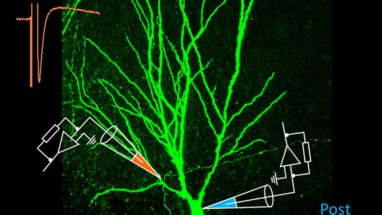 New Study Uncovers How a Unique Synapse Keeps Us From Falling