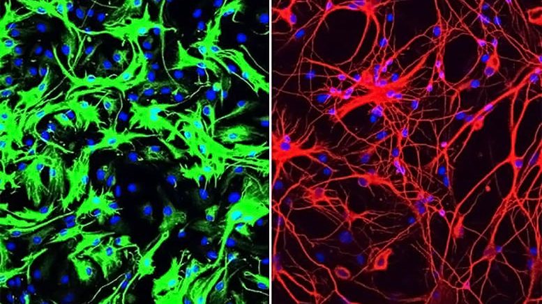 Mapping the Mouse Brain in Intricate Detail, and by Extension, the ...