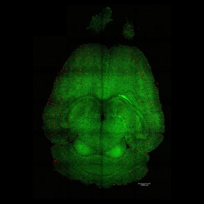Scientists Reverse Alzheimer’s Disease in Mice With Impressive New ...
