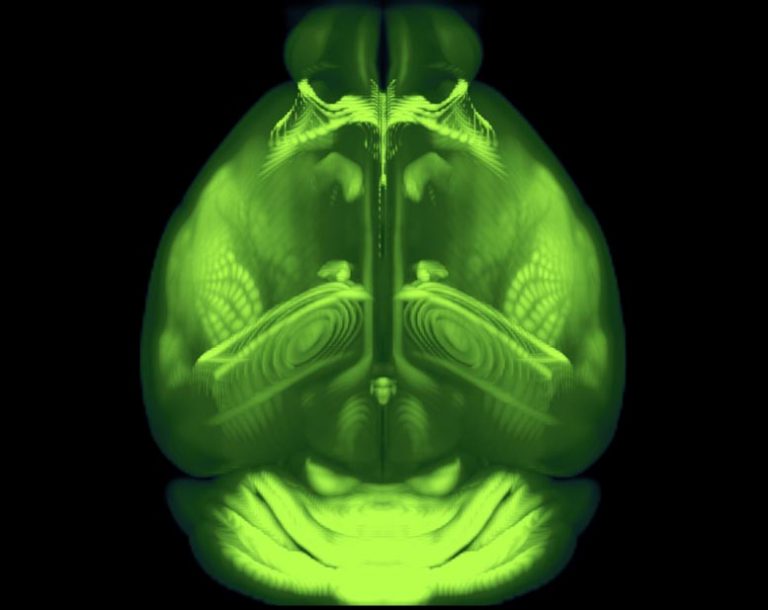 A New Complete, High-Resolution 3D Map of the Mouse Brain [Video]