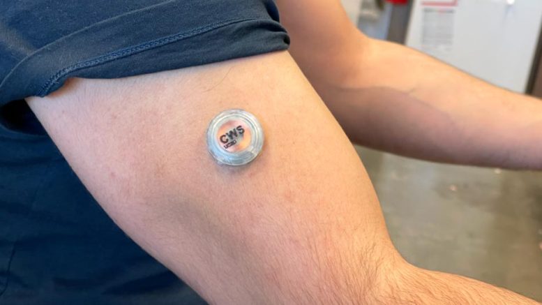 Painless Tattoos Developed – Easy, Do-It-Yourself Microneedle Patches