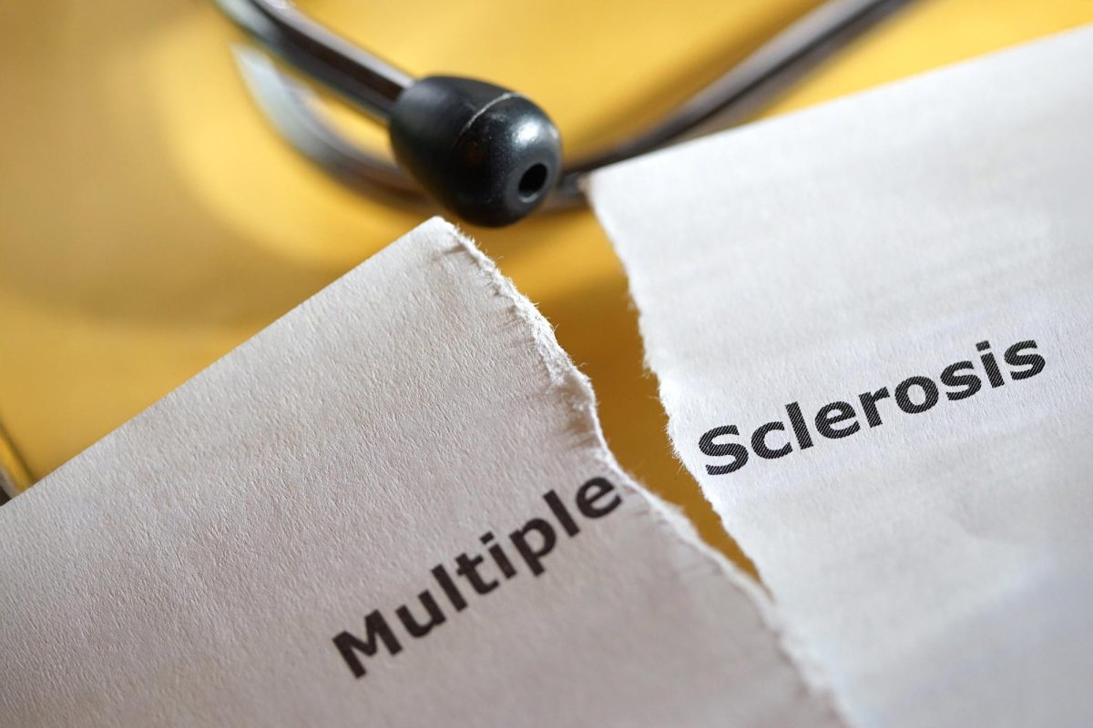 New Algorithm Dramatically Lowers MS Relapse Rates Across All Groups