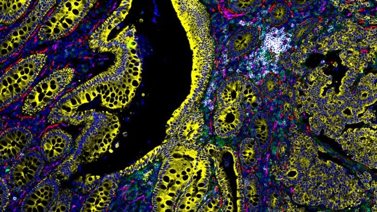 Outperforming Human Pathologists – New Harvard-Developed AI Tool ...