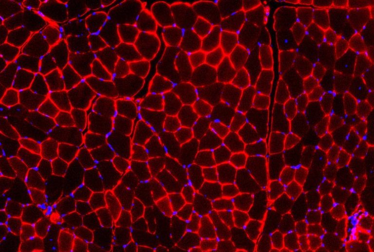 Weight Loss Revolution: New Breakthrough Could Prevent Muscle Loss ...