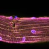 New Mechanism Discovered for Muscle Regeneration