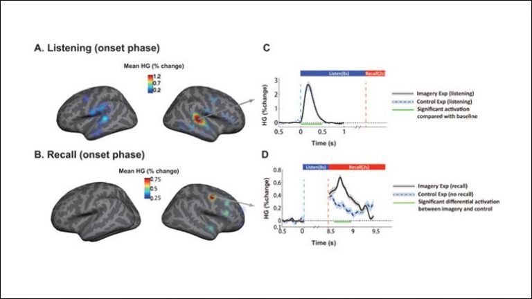 Watching Music Move Through the Brain