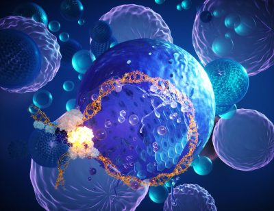 The Hidden Protein Driver Behind Prostate Cancer Revealed