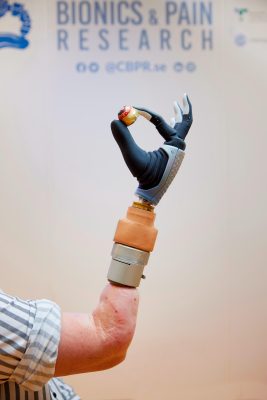 Revolutionizing Prosthetics – Scientists Develop Bionic Hand That ...