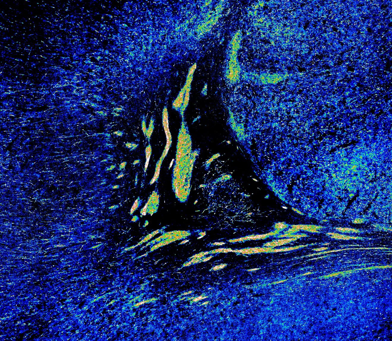 Brain Development Continues Far Beyond Birth, Study Finds