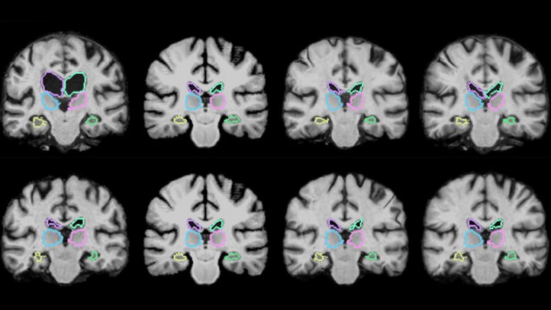 Mit Deep Learning Algorithm Finds Hidden Warning Signals In Measurements Collected Over Time