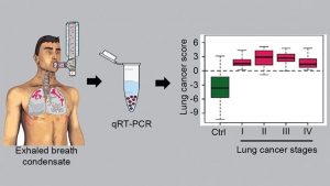 New Breath Test Provides Non‐Invasive Lung Cancer Diagnosis