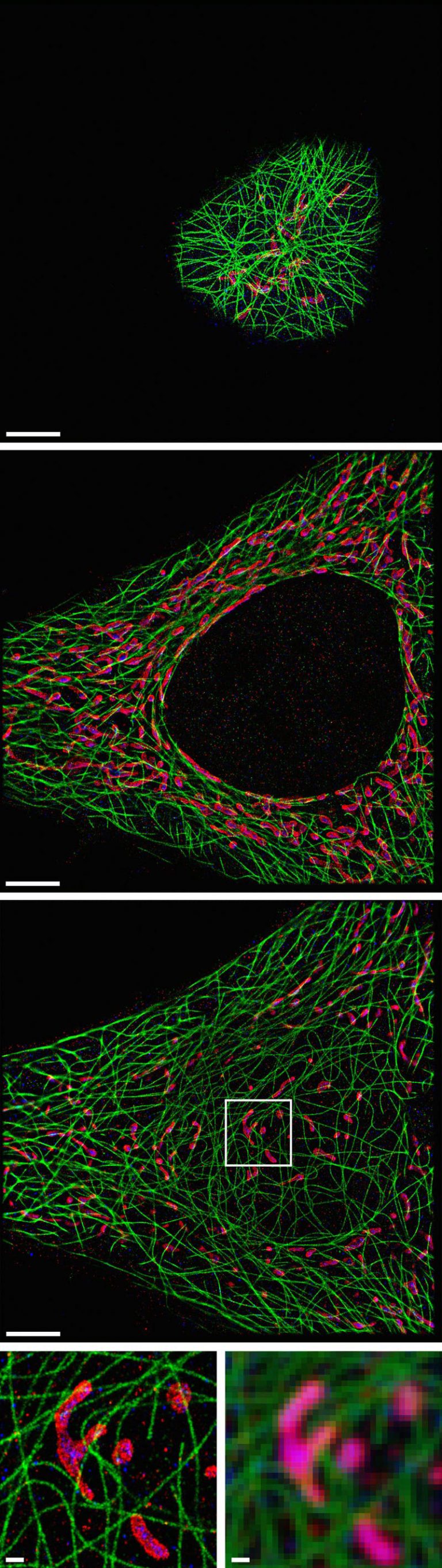 New Technique Visualizes Whole Cells at Super-Resolution
