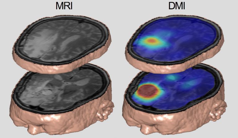 New Imaging Technique Captures Detailed Information About Metabolism