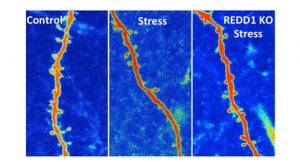 Neurobiologists Block the Effects of Stress