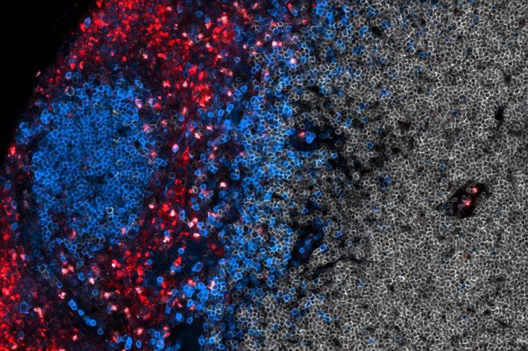 New Super-Charged Treatment Boosts T-Cell Therapy