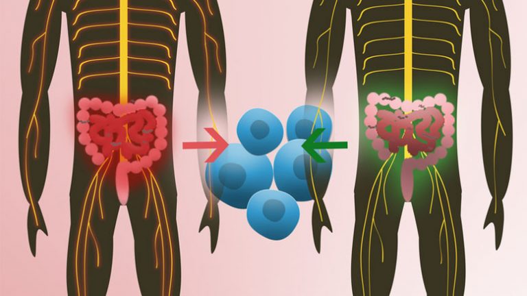 Human Intestinal Bacteria Can Trigger Multiple Sclerosis