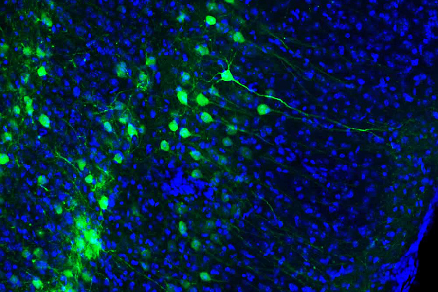 "Silent Engrams" Build a Case for a New Theory of Memory Formation