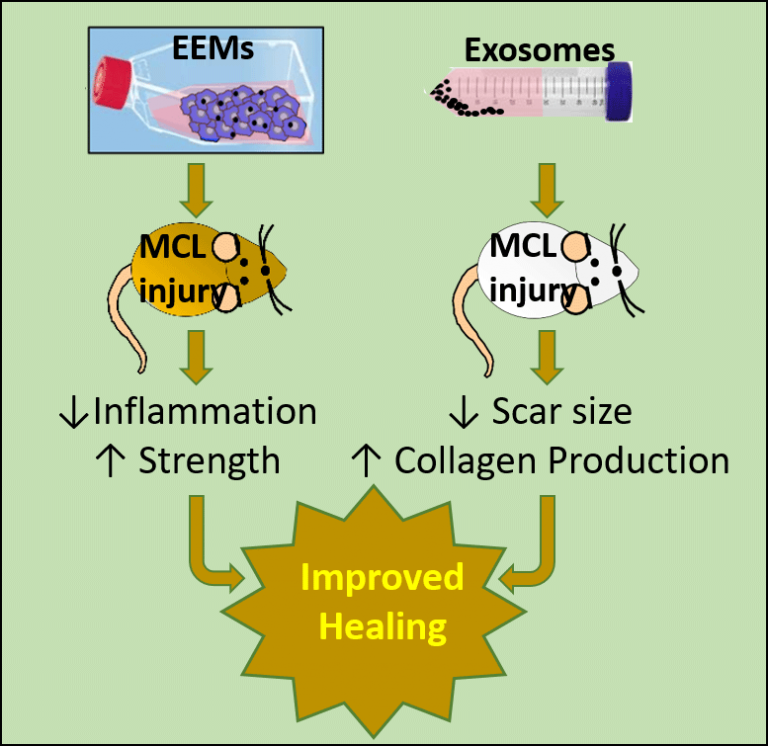 Possible New Treatment to Speed Healing of Ligament Injuries