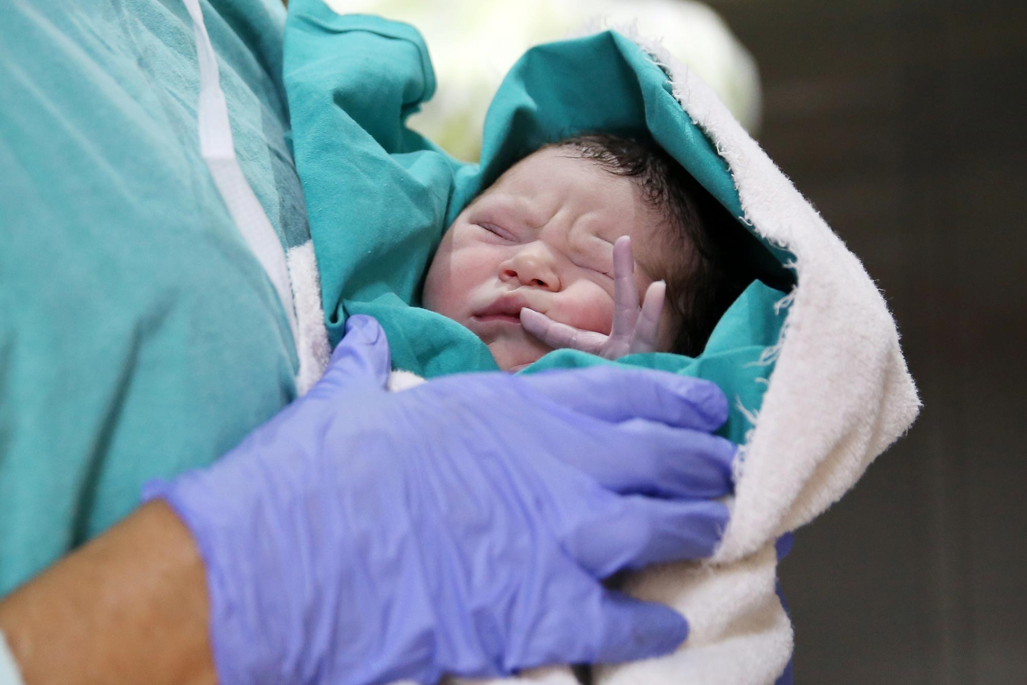 Babies Born With Birth Defects Babies Born With Birth Defects