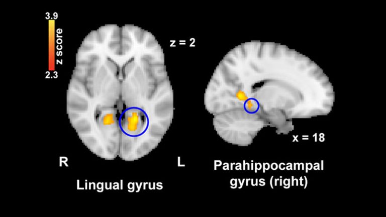 Nostalgia Can Relieve Pain: Viewing Images From Childhood Reduces Pain ...