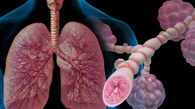 3D Printed Airway Splint Saves Baby's Life