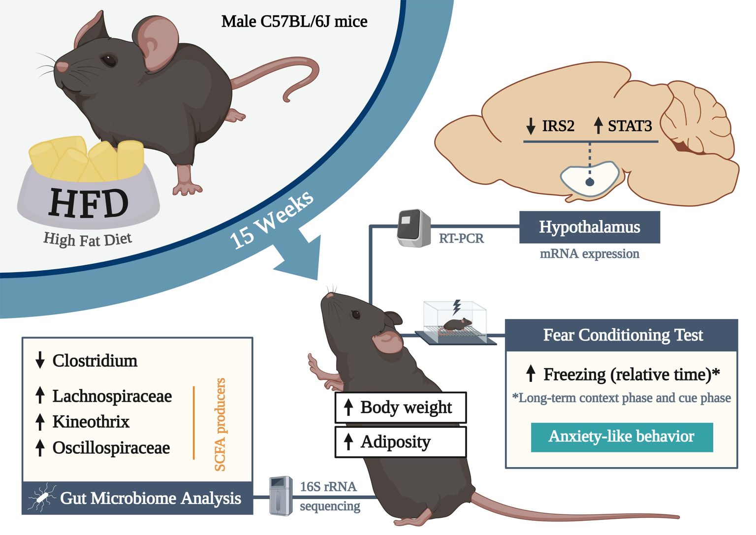 Brain on Fat: Study Reveals How Diet May Drive Anxiety