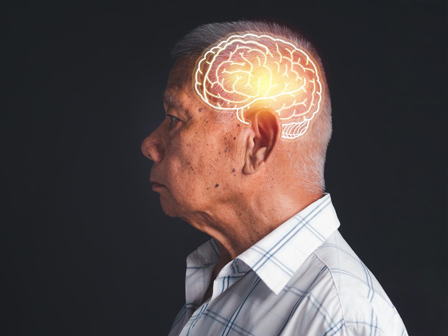 Alzheimer’s May Begin Decades Earlier Than You Think, New Mayo Clinic ...
