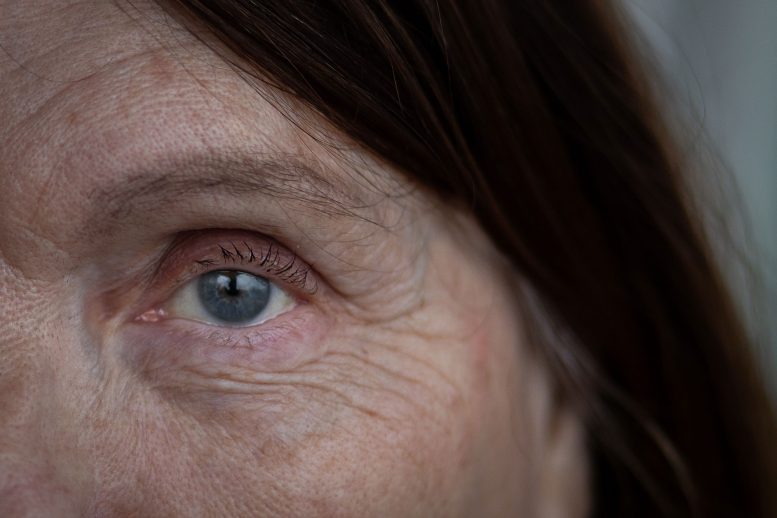Groundbreaking New Treatment Is the First to Halt This Common Eye Disease