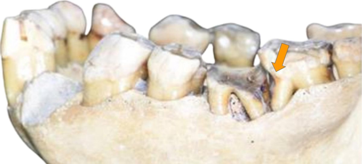 Primate Teeth Just Rewrote a Key Chapter of Human Evolution