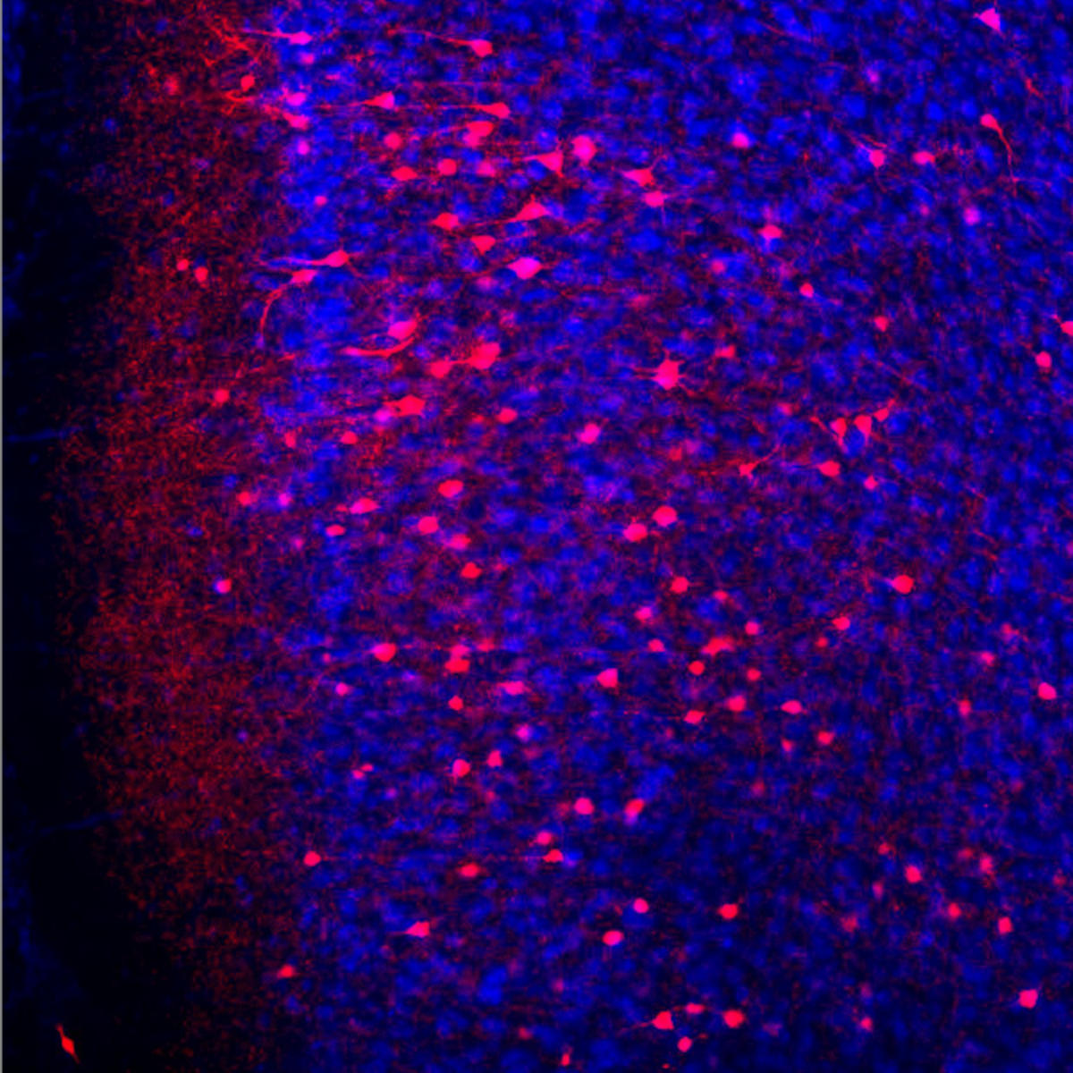 Paving the Way for New PTSD Treatments – Scientists Reveal How the ...