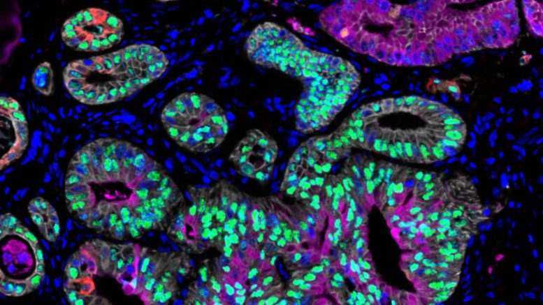 Scientists Develop “Nanomachines” That Can Penetrate and Kill Cancer Cells