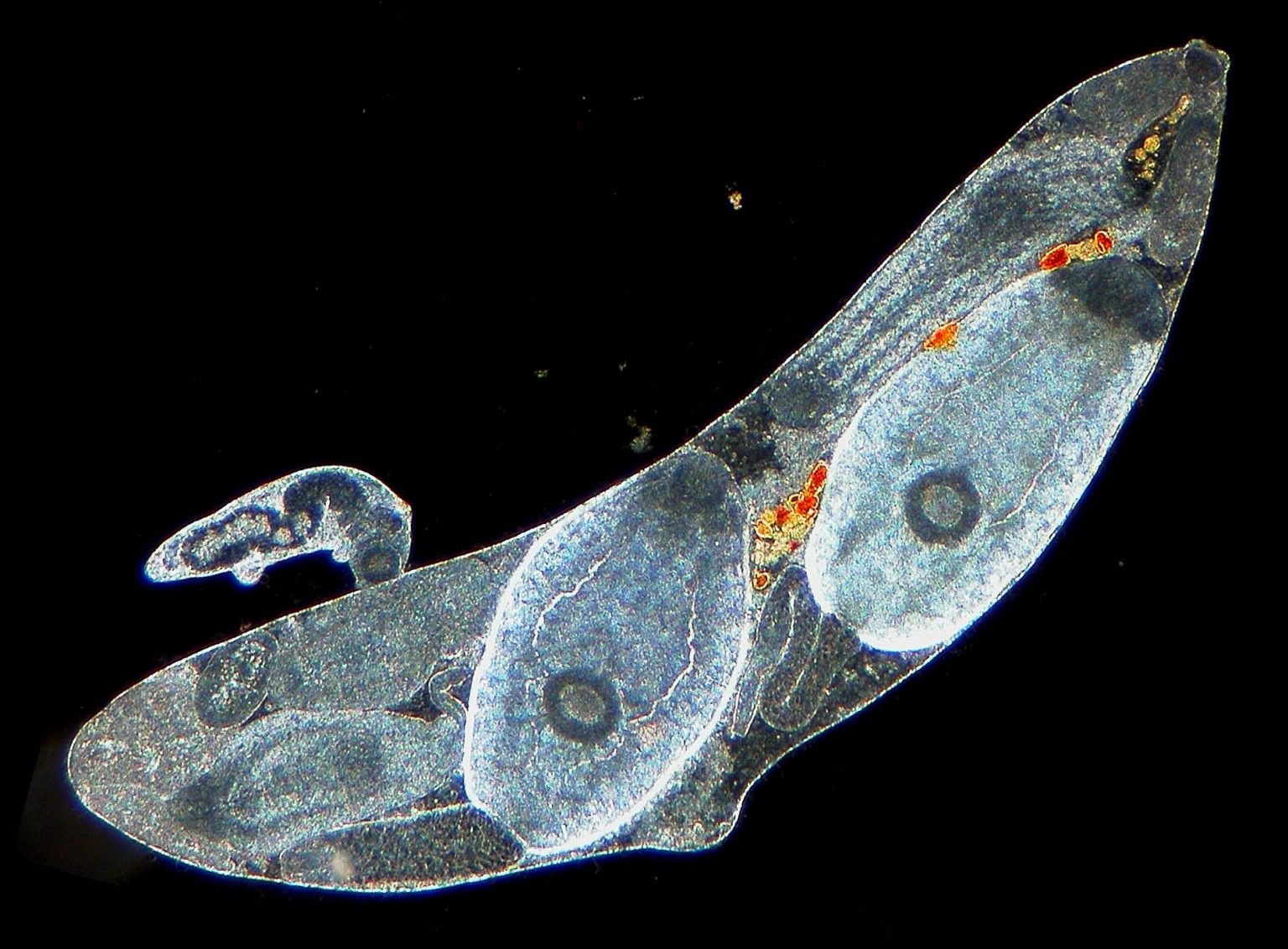 Invasion: Parasitic Worms Have Armies – Produce More Soldiers to Meet ...