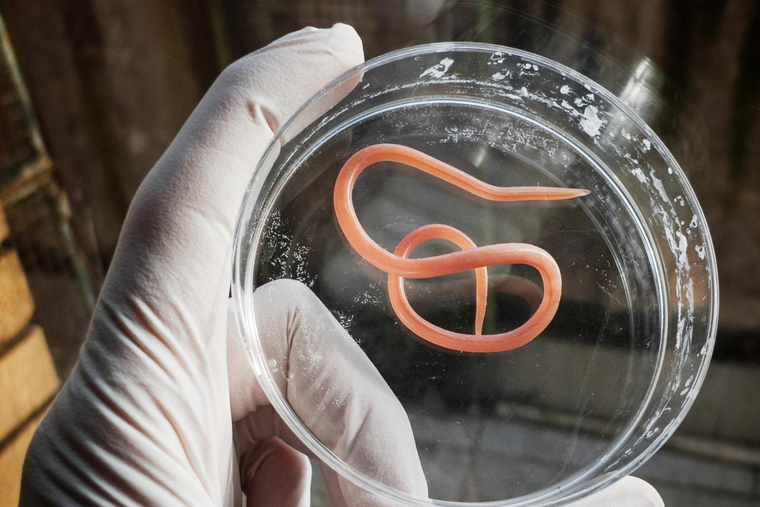 Surgeons Pull 3″ Parasitic Worm From Woman’s Brain – Still Alive and ...