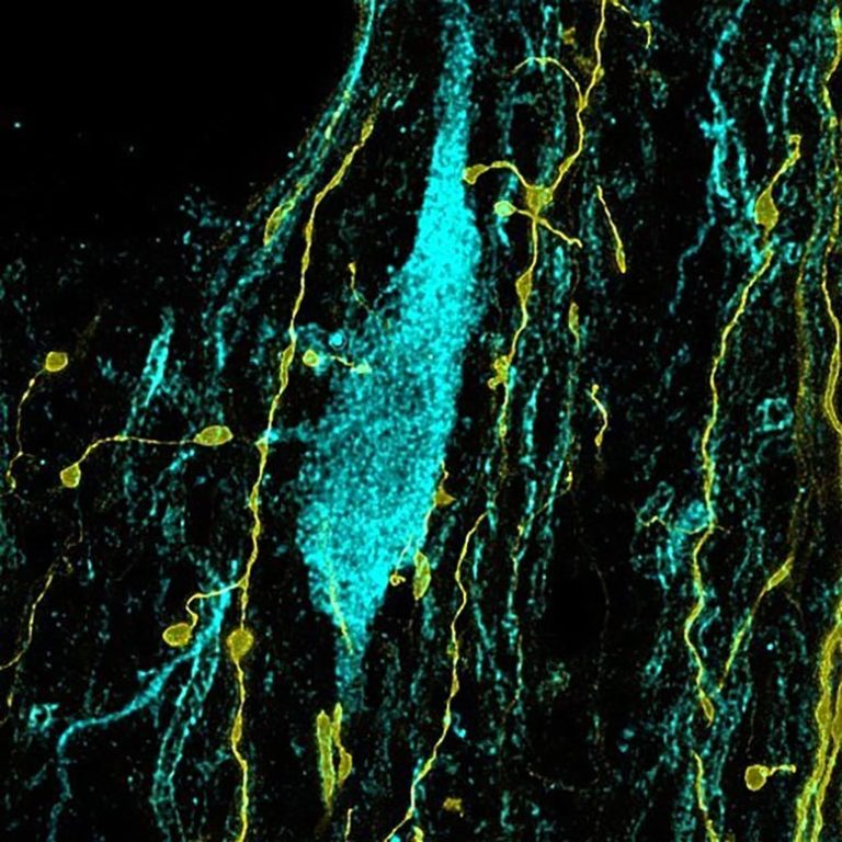 Wiring Wisdom: How the Brain Learns From Fear and Failure