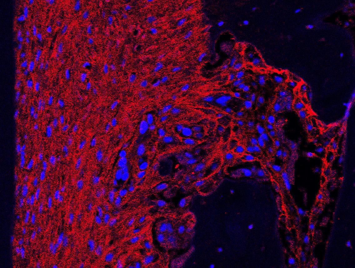 Key New Molecules Uncovered That Could Help Tackle Tooth Loss and ...