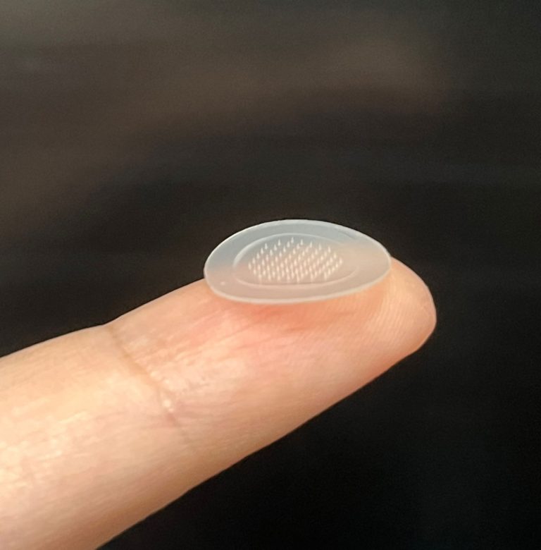 New Smart Pimple Patch Clears Acne in Just 7 Days