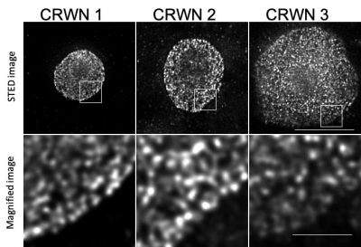 How the Architecture of the Cell Nucleus Can Change Gene Activity in Plants