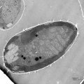 Scientists Unravel the Unusual Cell Biology Behind Toxic Algal Blooms