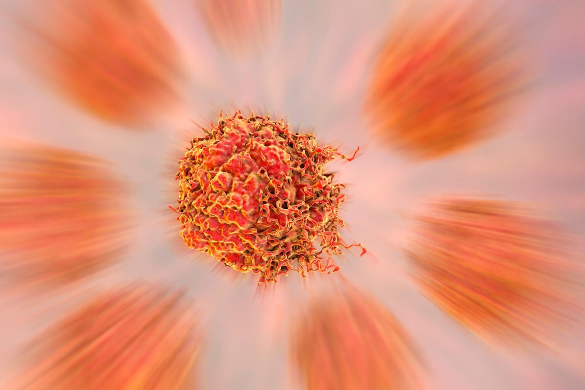 A 10-Second Steam Blast: The New Weapon Against Prostate Cancer?