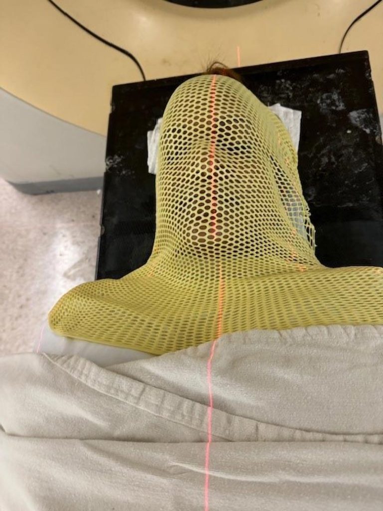 Breakthrough Proton Therapy Wipes Out Rare Cancer With No Side Effects