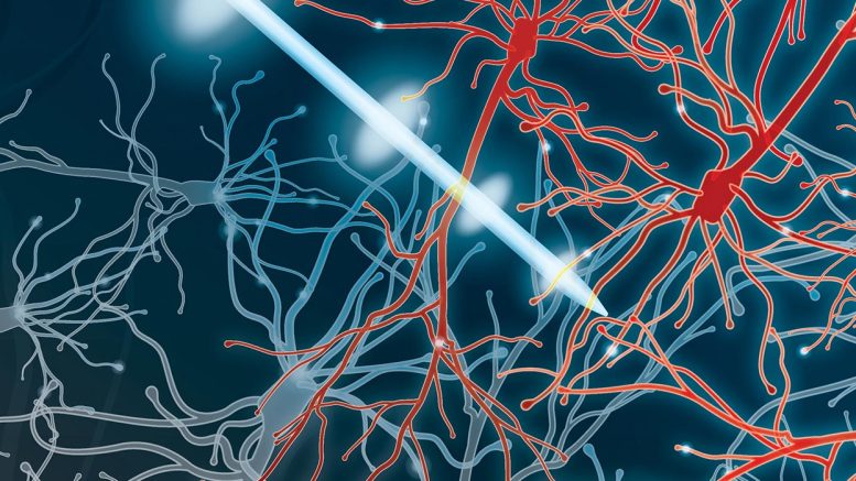 A Promising Therapy for Hard-To-Treat Depression: Deep Brain Stimulation