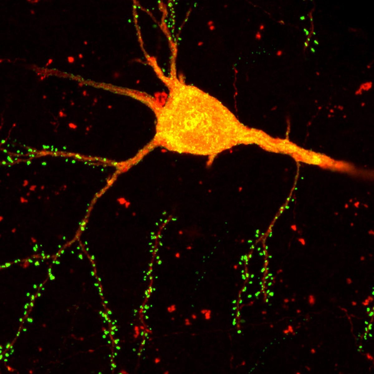 New Brain-Mapping Tech Could Revolutionize Treatments for Neurological ...
